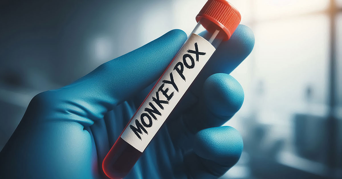 Protectus Viridis vs Monkeypox - RBT Global